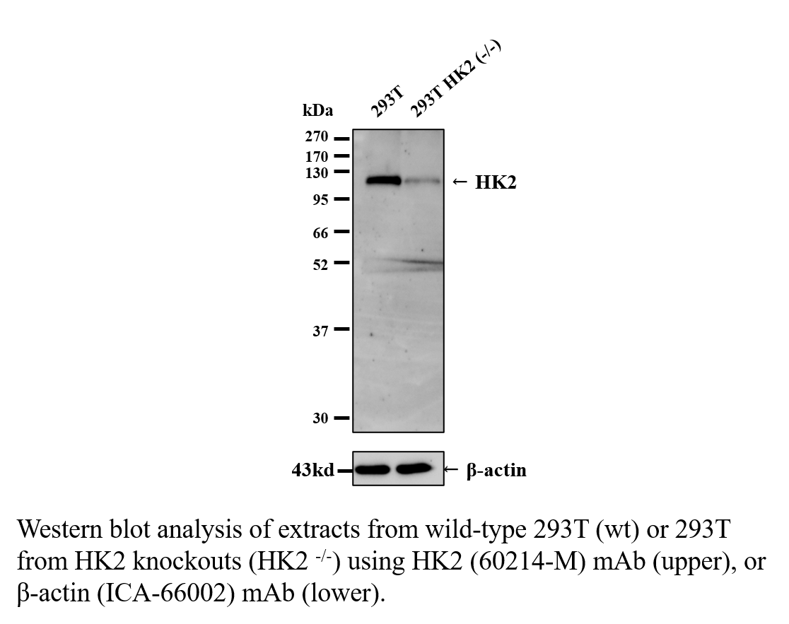 HK2_重庆昆仑生物有限公司