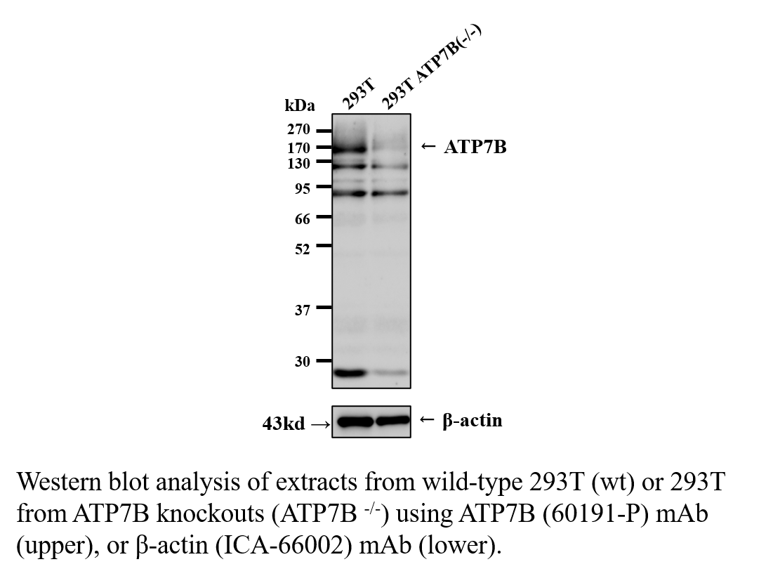 ATP7B_重庆昆仑生物有限公司